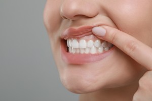 What the Color of Your Gums Says About Your Health | A Guide
